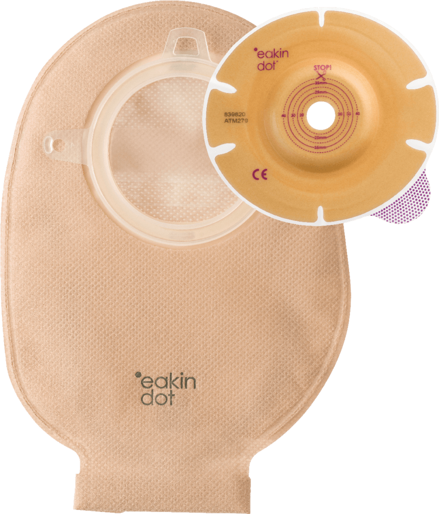 Stoma case study | Retracted stoma and parastoma hernia | eakin®